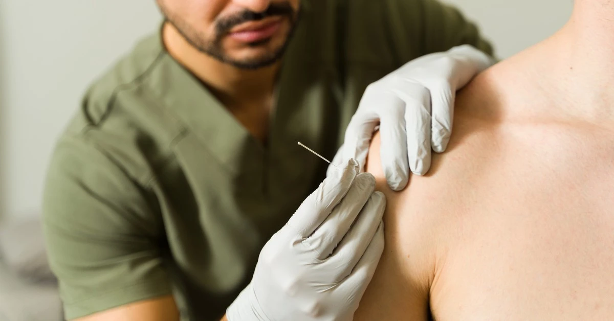 Exploring Functional Dry Needling: A Physical Therapist’s Guide to Pain ...